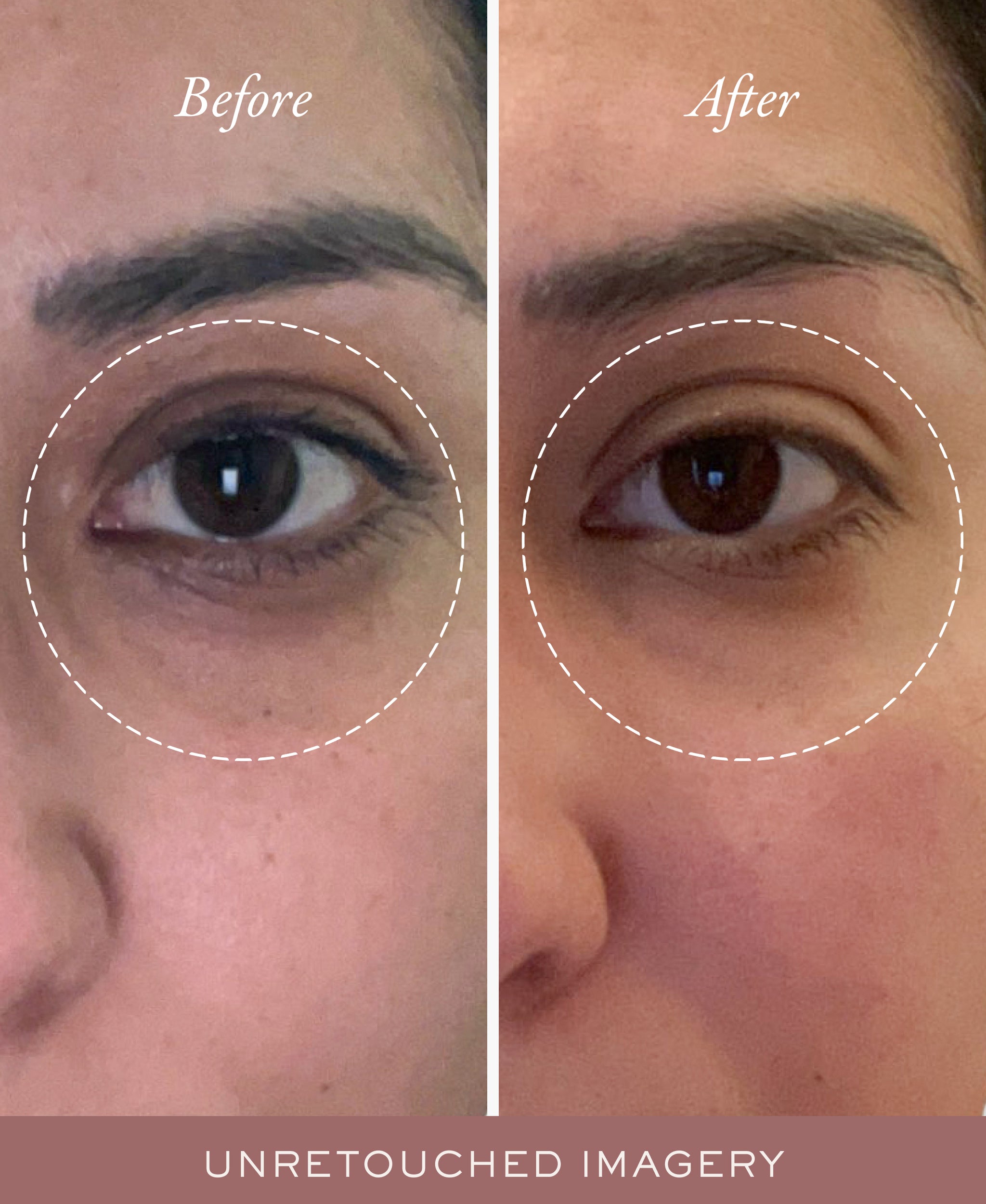 Golden Glow Eye Balm – Sahajan